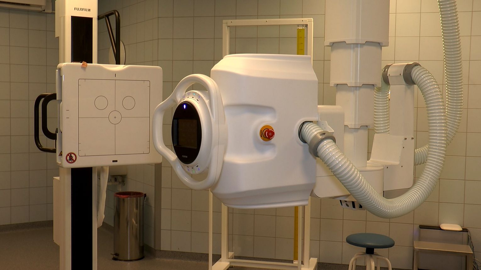 Szpital w Radomsku wyposażył się w nowoczesny aparat RTG. To najnowszy ...